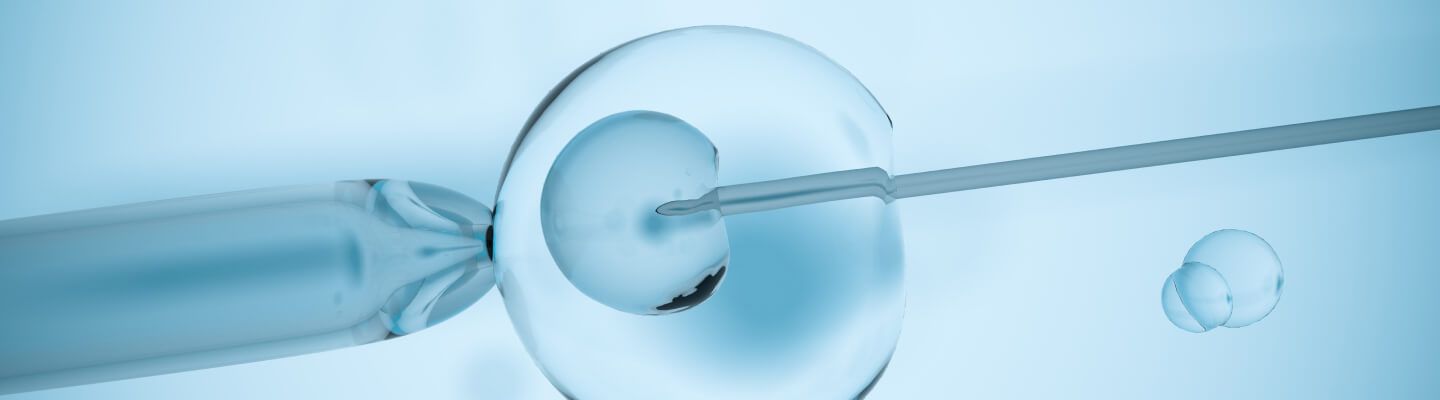 Intrauterine insemination - FIVI Fertility & IVF Center