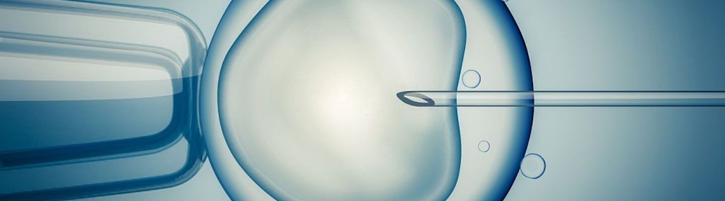 Embryo transfer - FIVI Fertility & IVF Center